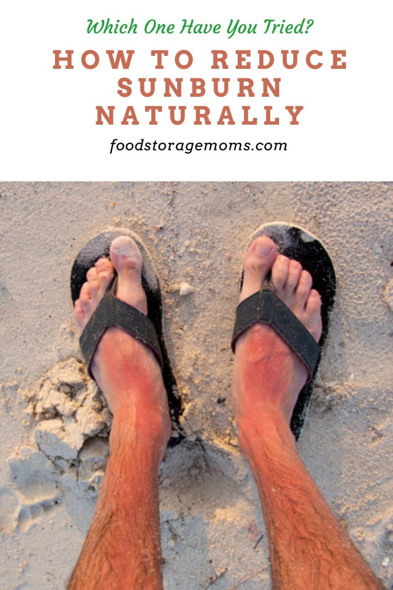 How To Reduce Sunburn Naturally Food Storage Moms